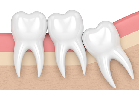 Υπηρεσίες | Οδοντιατρείο Dental Clinic - Ελευθερία Μιχαλιάνου